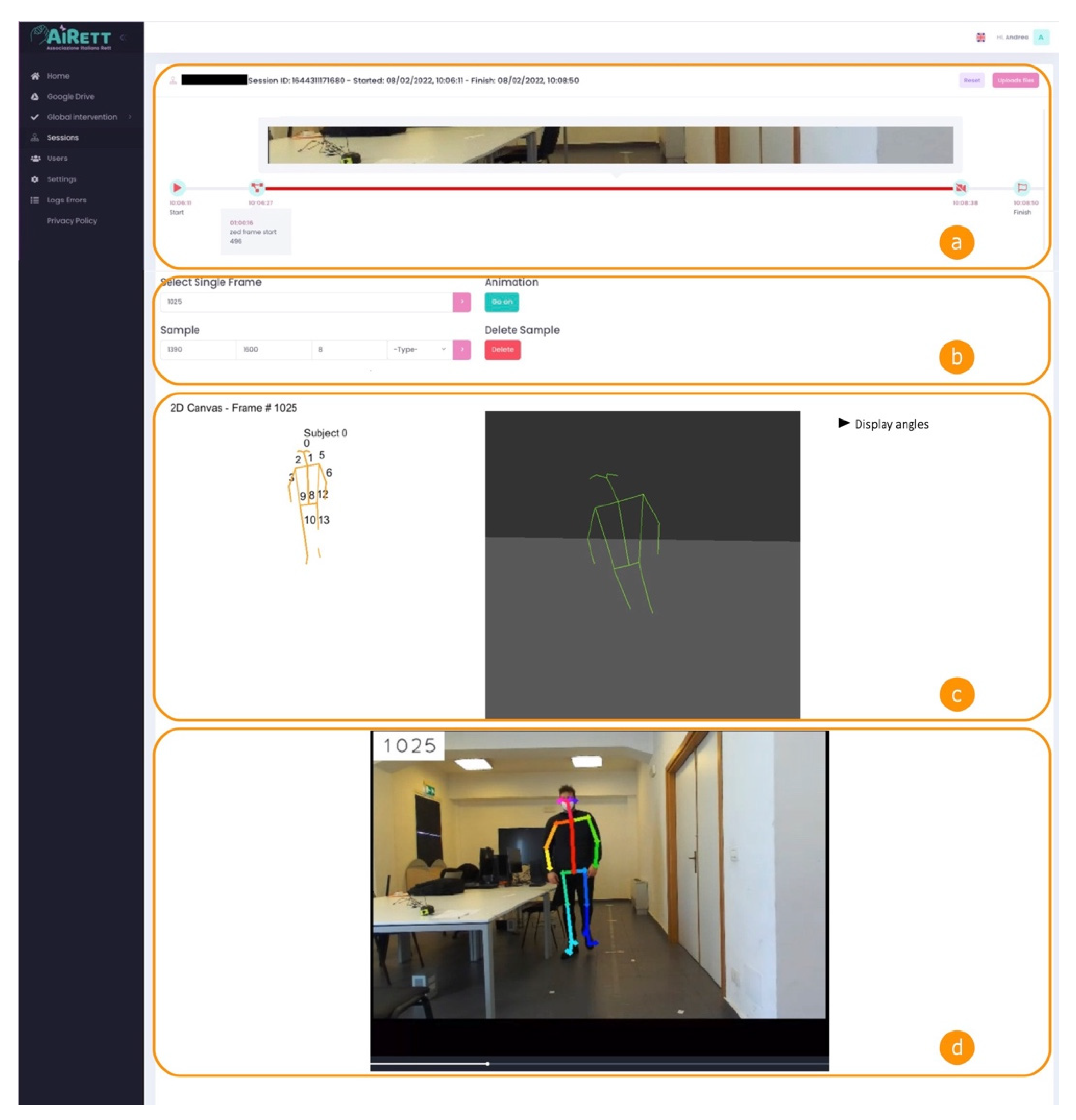 Telerehabilitation with Computer Vision-Assisted Markerless Measures: A ...