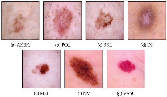A Skin Disease Classification Model Based on DenseNet and ConvNeXt Fusion