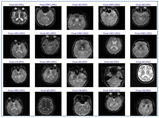 A Novel Framework for Classification of Different Alzheimer’s Disease ...