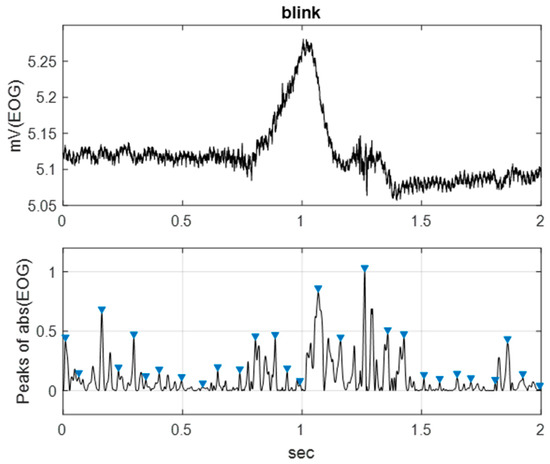 A Wireless Electrooculogram (EOG) Wearable Using Conductive Fiber Electrode