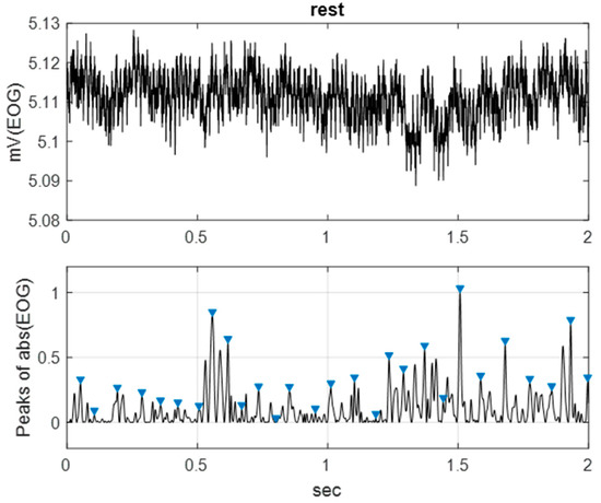A Wireless Electrooculogram (EOG) Wearable Using Conductive Fiber Electrode