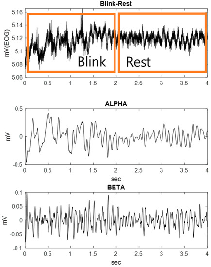 A Wireless Electrooculogram (EOG) Wearable Using Conductive Fiber Electrode