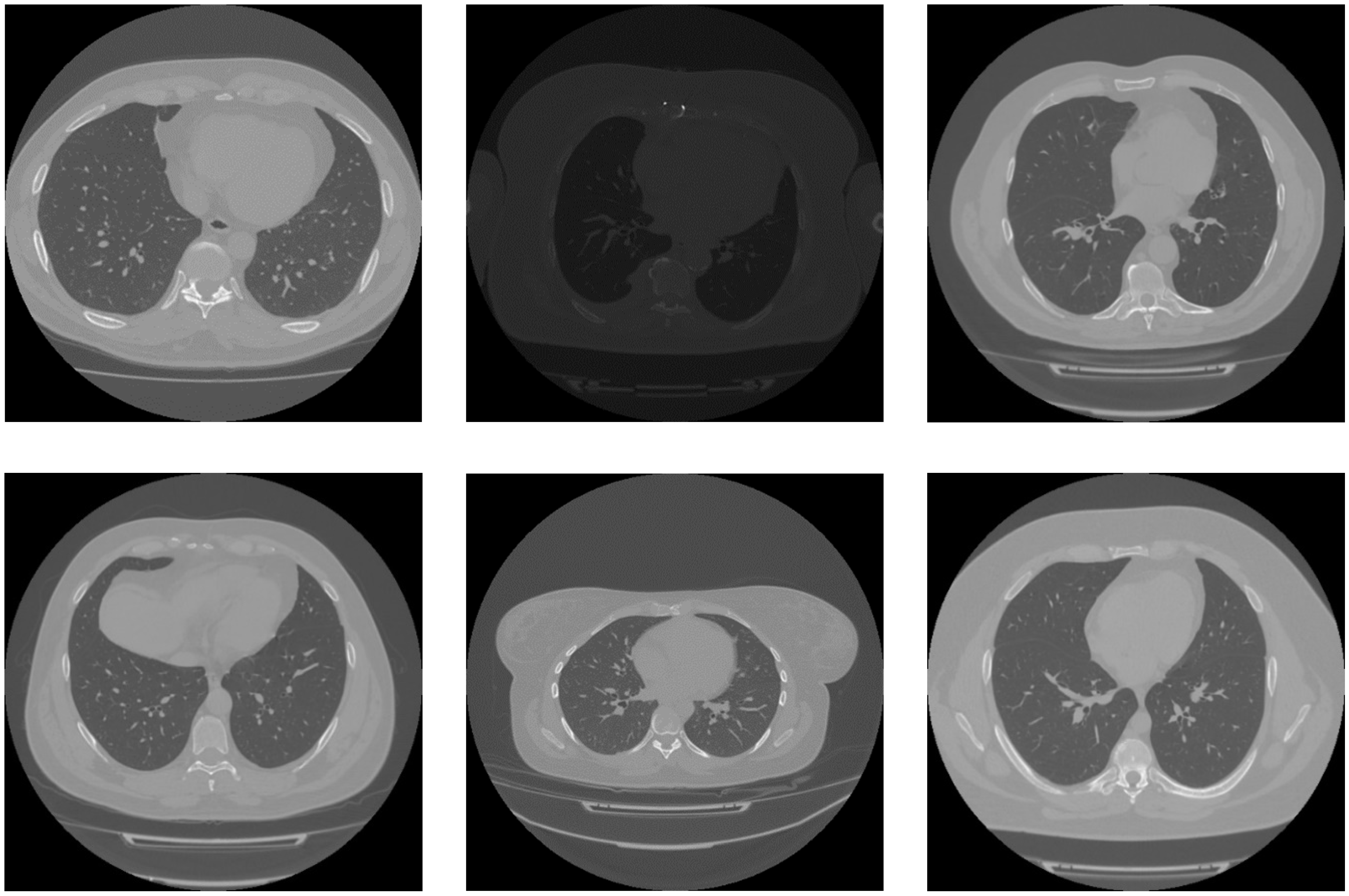 Electronics | Free Full-Text | Deep Feature Meta-Learners Ensemble Models for COVID-19 CT Scan ...