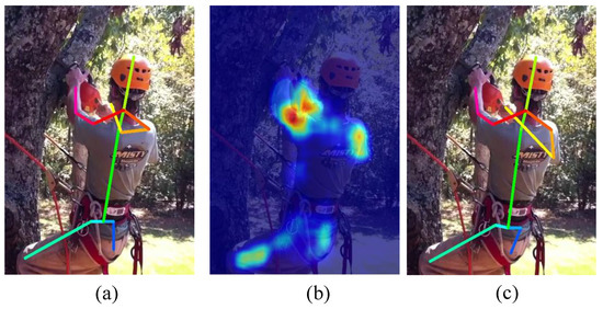 Electronics | Free Full-Text | Human Pose Estimation via Dynamic ...