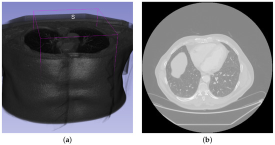 A Novel Geometric Parameter Self-Calibration Method for Portable CBCT ...