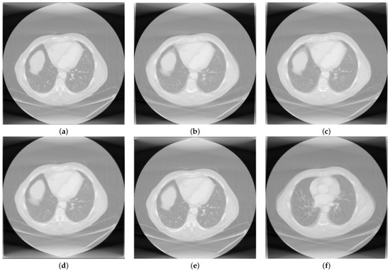 A Novel Geometric Parameter Self-Calibration Method for Portable CBCT ...