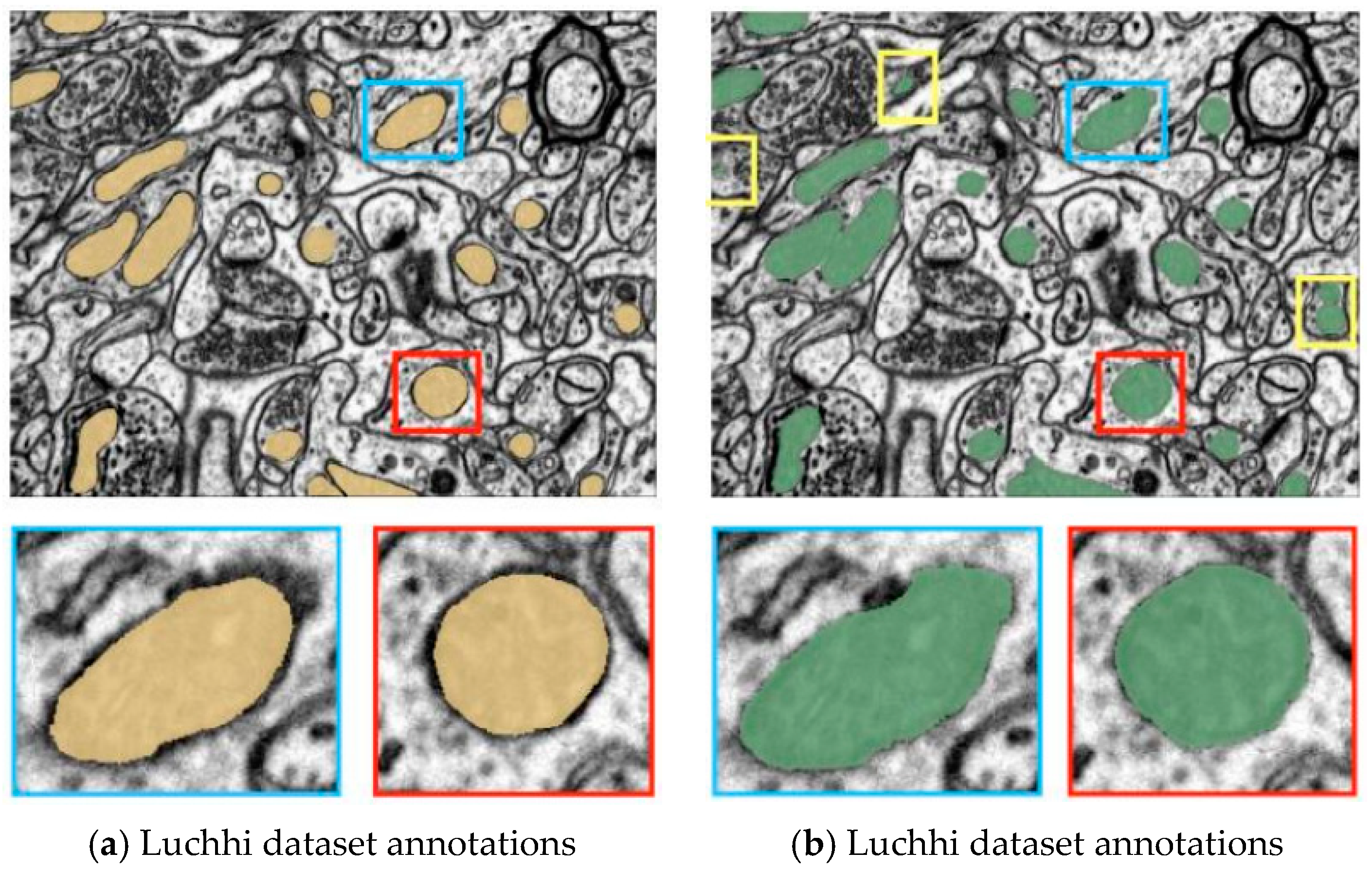 Electronics | Free Full-Text | Two-Stage Cascaded CNN Model for 3D Mitochondria EM Segmentation