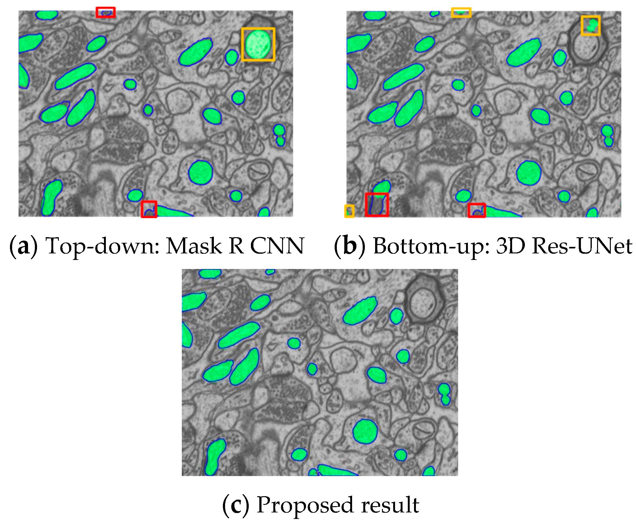 Electronics | Free Full-Text | Two-Stage Cascaded CNN Model for 3D Mitochondria EM Segmentation
