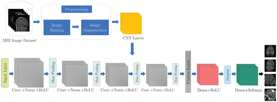 Electronics | Free Full-Text | Classifying Brain Tumors on Magnetic ...
