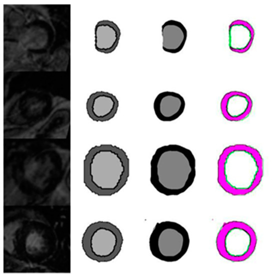 Effects of Image Size on Deep Learning
