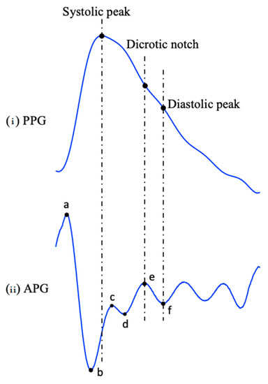 A Novel Fiducial Point Extraction Algorithm to Detect C and D Points from the Acceleration ...