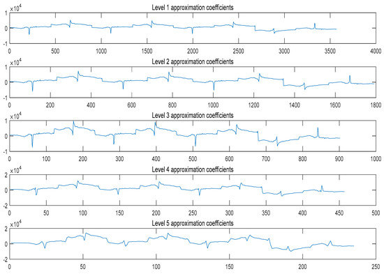 Research on Improved Wavelet Threshold Denoising Method for Non-Contact ...