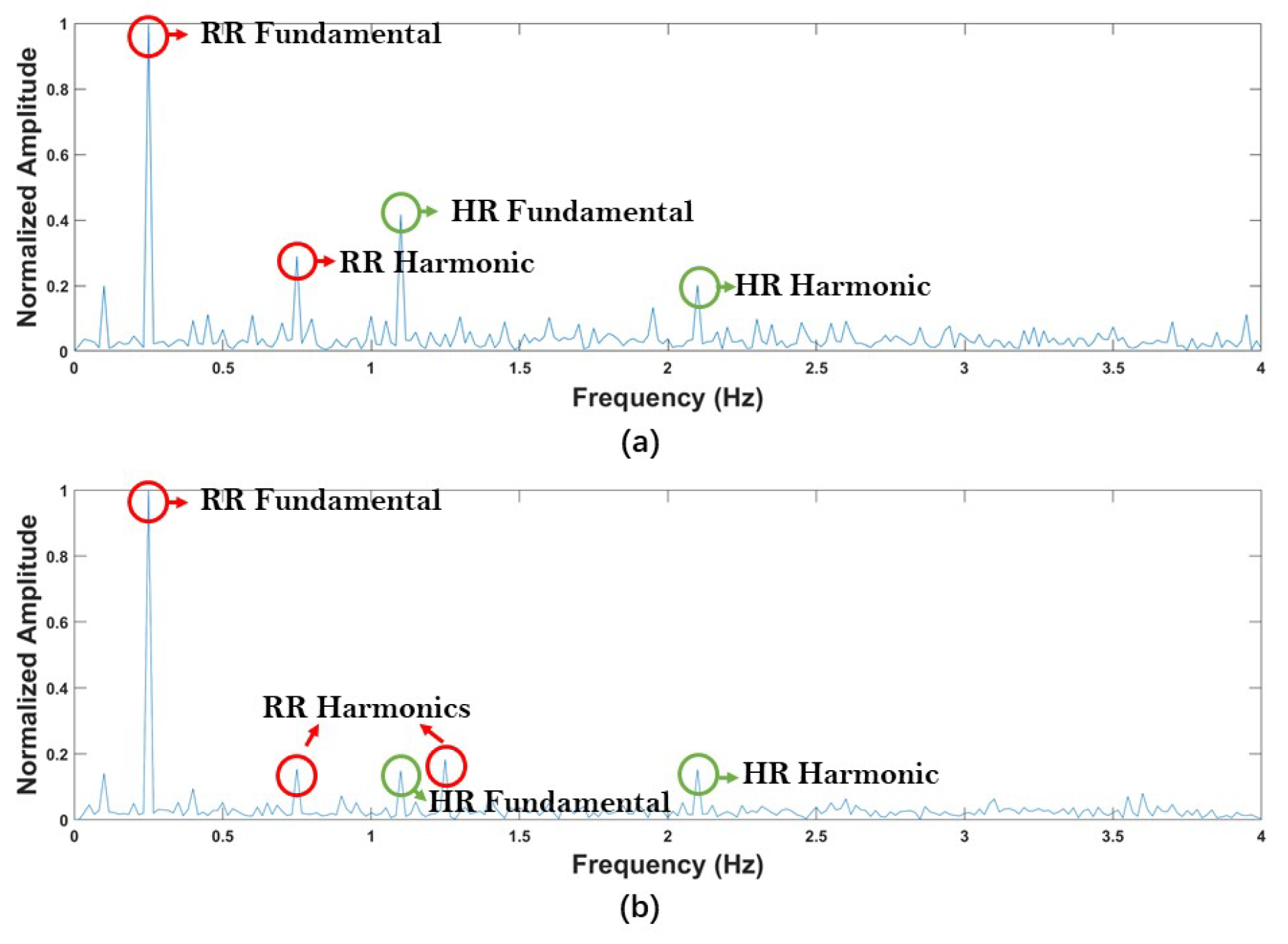 Non-Contact Human Vital Signs Extraction Algorithms Using IR-UWB Radar: A Review