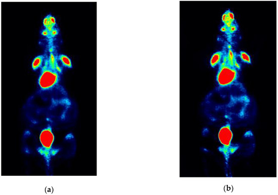 Optimization of the Algorithm for the Implementation of Point Spread Function in the 3D-OSEM ...