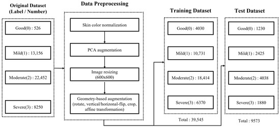 Deep-Learning-Based Scalp Image Analysis Using Limited Data