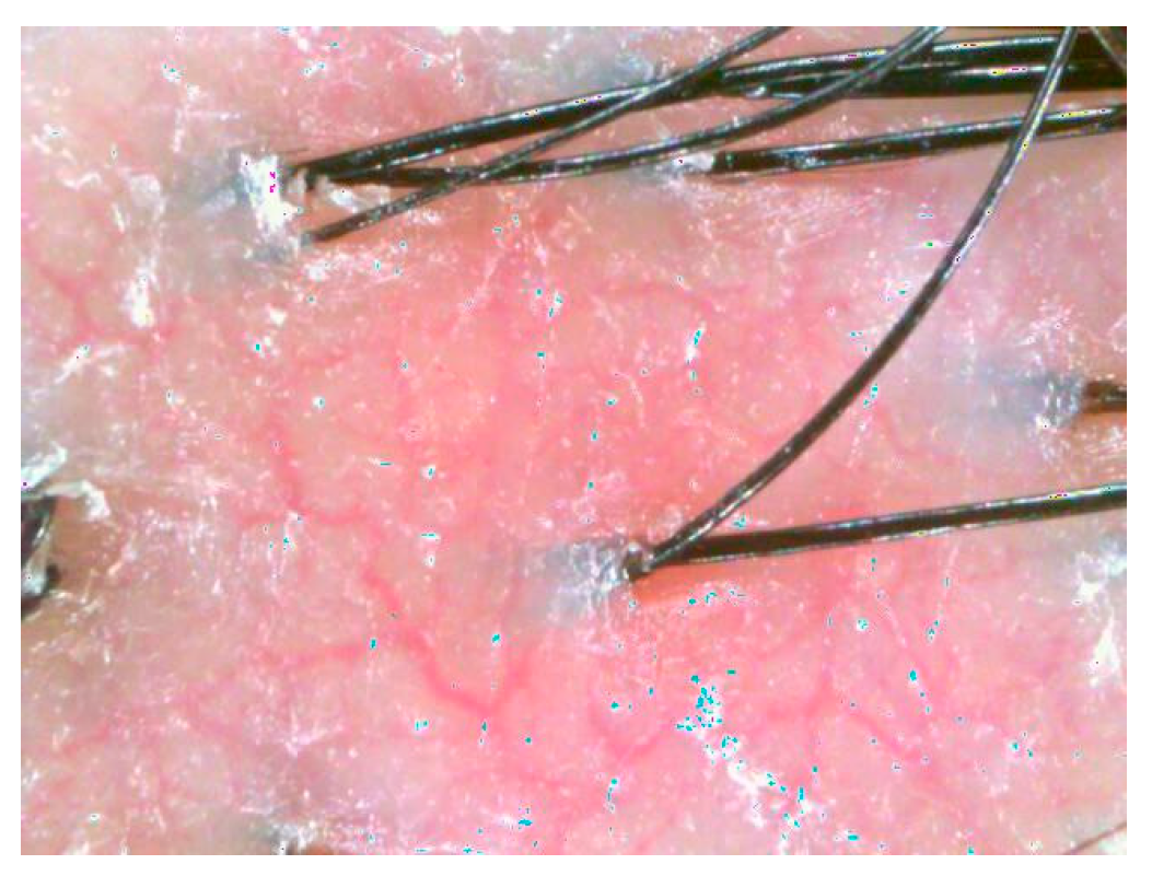 Deep-Learning-Based Scalp Image Analysis Using Limited Data