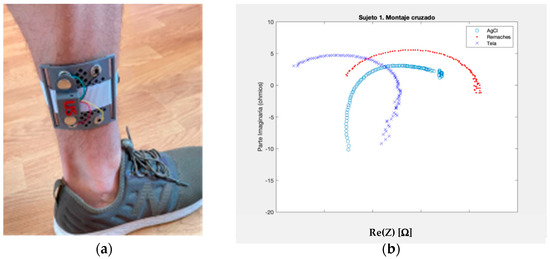 From Bioimpedance to Volume Estimation: A Model for Edema Calculus in ...