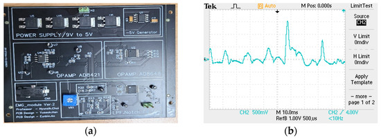 Electromyogram (EMG) Signal Classification Based on Light-Weight Neural Network with FPGAs for ...