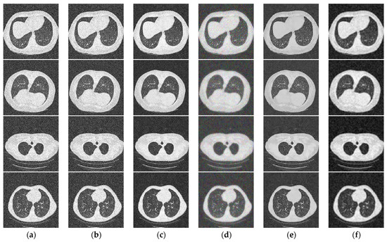 A Novel Denoising Algorithm Based on Wavelet and Non-Local Moment Mean ...