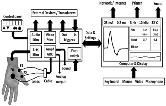 Electromyography Monitoring Systems in Rehabilitation: A Review of ...