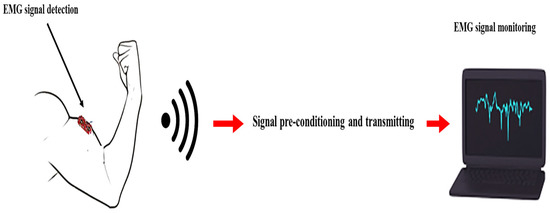 Electromyography Monitoring Systems in Rehabilitation: A Review of ...