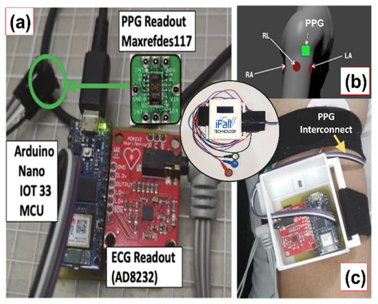 An Unobtrusive, Wireless and Wearable Single-Site Blood Pressure ...