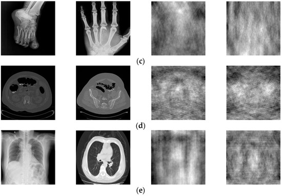 Hybrid Encrypted Watermarking Algorithm for Medical Images Based on DCT and Improved DarkNet53