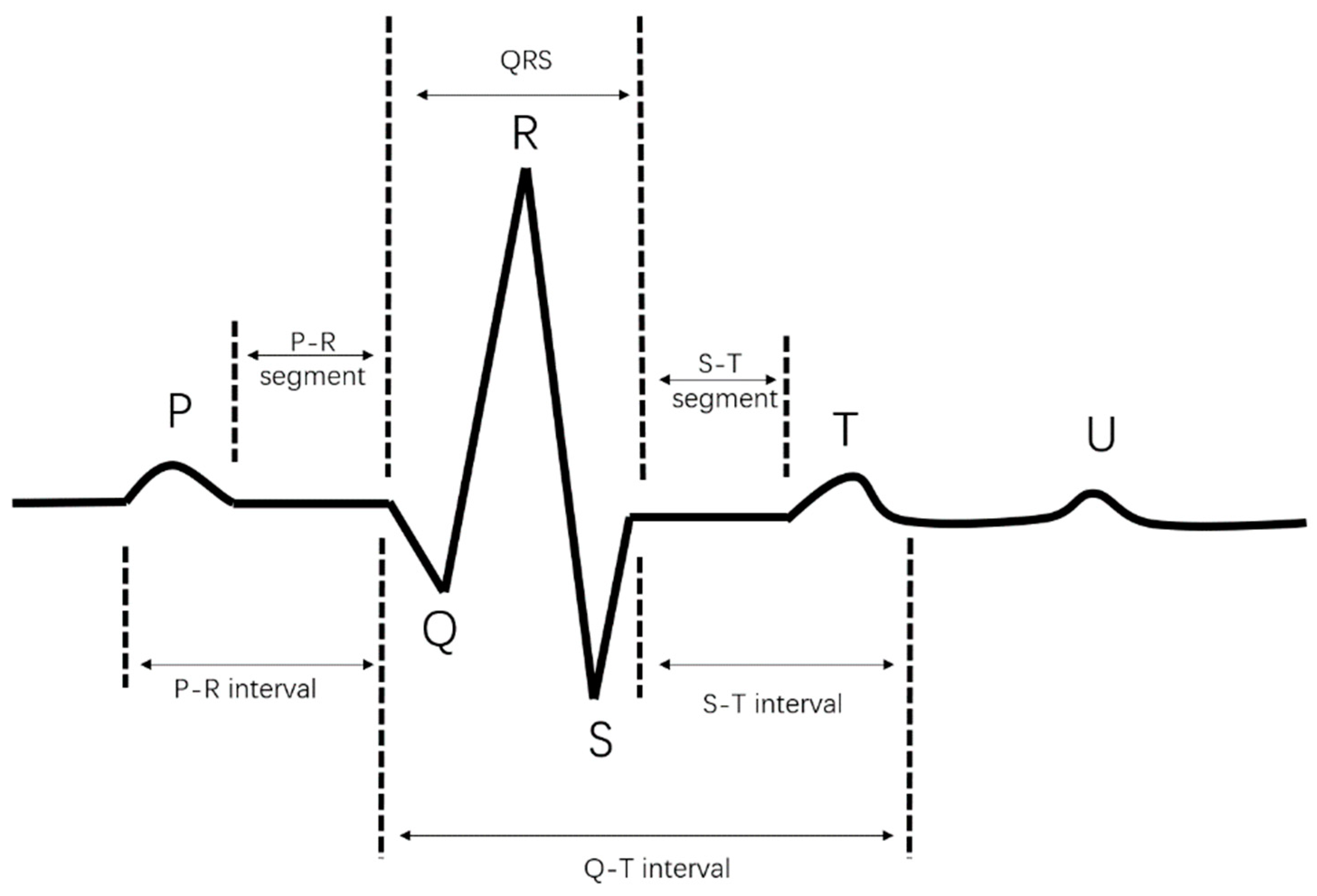 ECG Signal Denoising Method Based on Disentangled Autoencoder ECG Signal Denoising Method Based on Disentangled Autoencoder