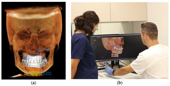 AI-Assisted CBCT Data Management in Modern Dental Practice: Benefits ...