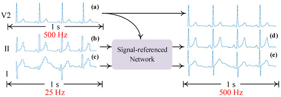 A Novel Method for ECG Signal Compression and Reconstruction: Down ...