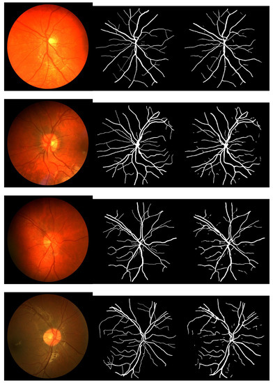 Electronics | Free Full-Text | LUVS-Net: A Lightweight U-Net Vessel ...