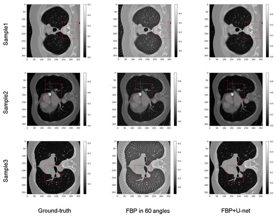 Novel Design of Industrial Real-Time CT System Based on Sparse-View ...