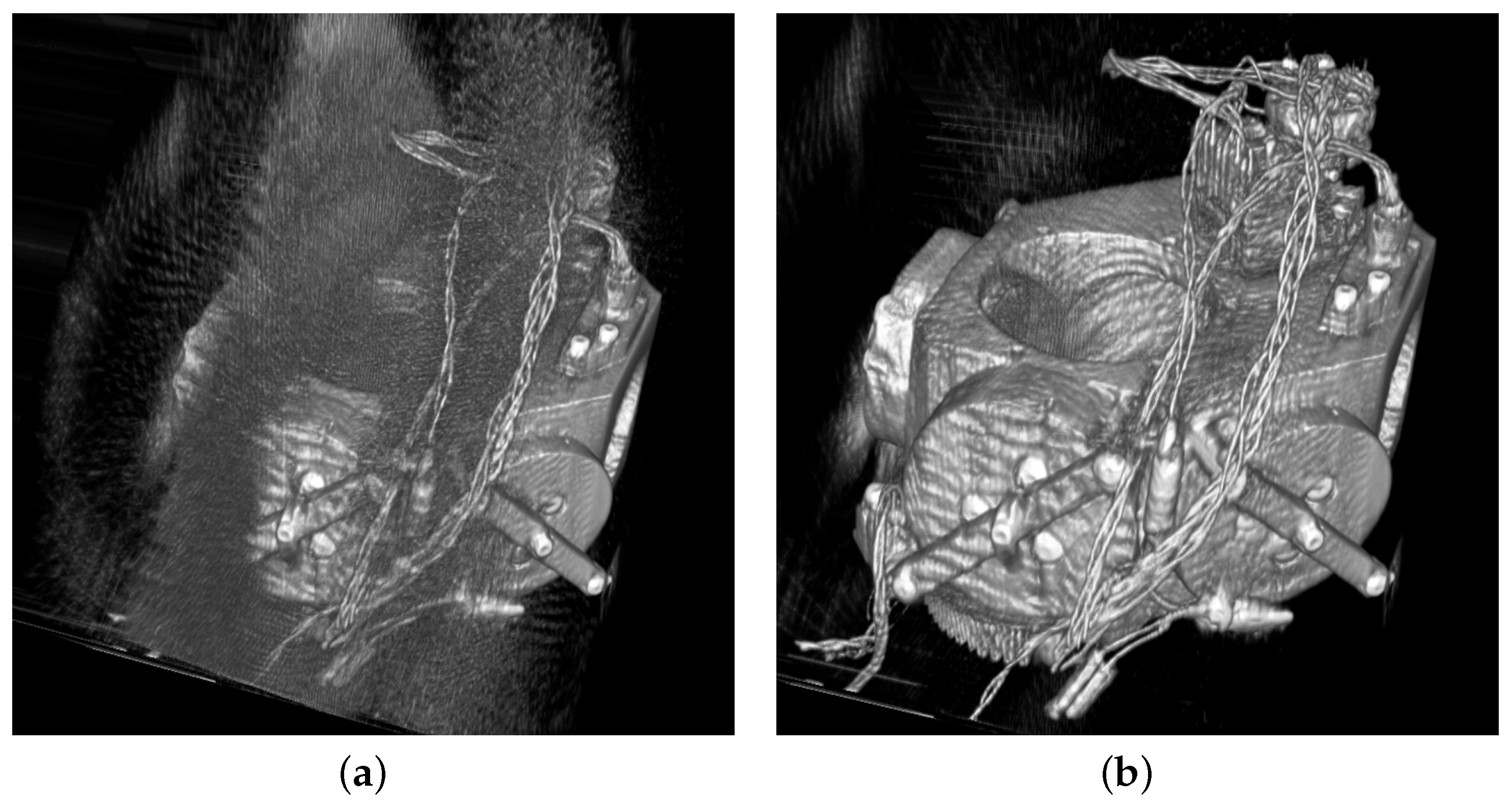 Novel Design of Industrial Real-Time CT System Based on Sparse-View ...