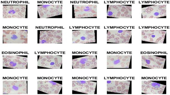 Deep and Hybrid Learning Techniques for Diagnosing Microscopic Blood ...