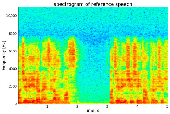 Electronics | Free Full-Text | A Novel End-to-End Turkish Text-to ...