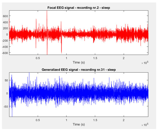 A Novel Automated Empirical Mode Decomposition (EMD) Based Method and Spectral Feature ...
