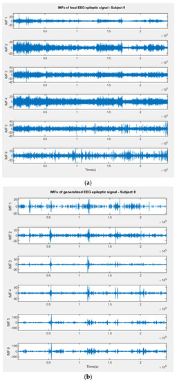A Novel Automated Empirical Mode Decomposition (EMD) Based Method and ...