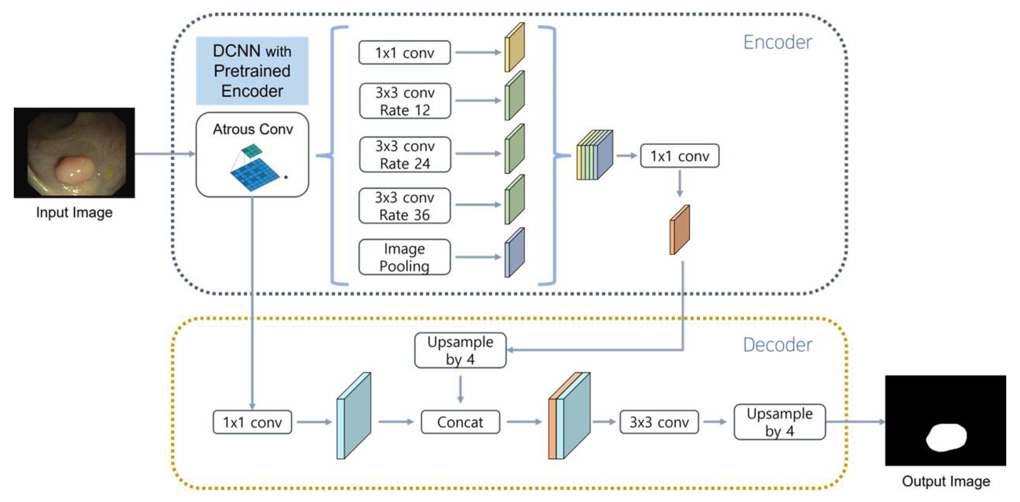 Lightweight Deep Learning Model for Real-Time Colorectal Polyp Segmentation