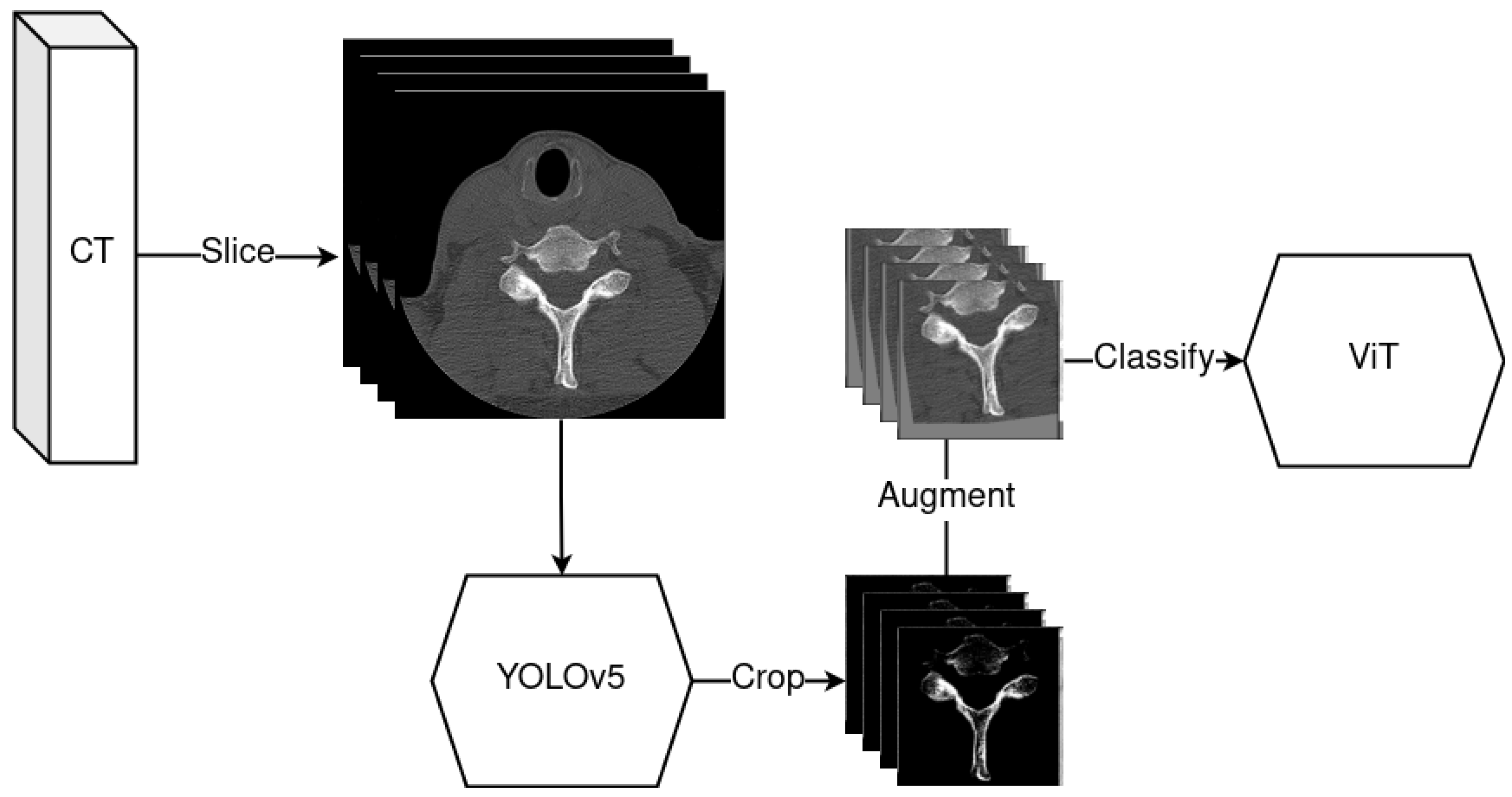 Deep Learning and Cloud-Based Computation for Cervical Spine Fracture ...