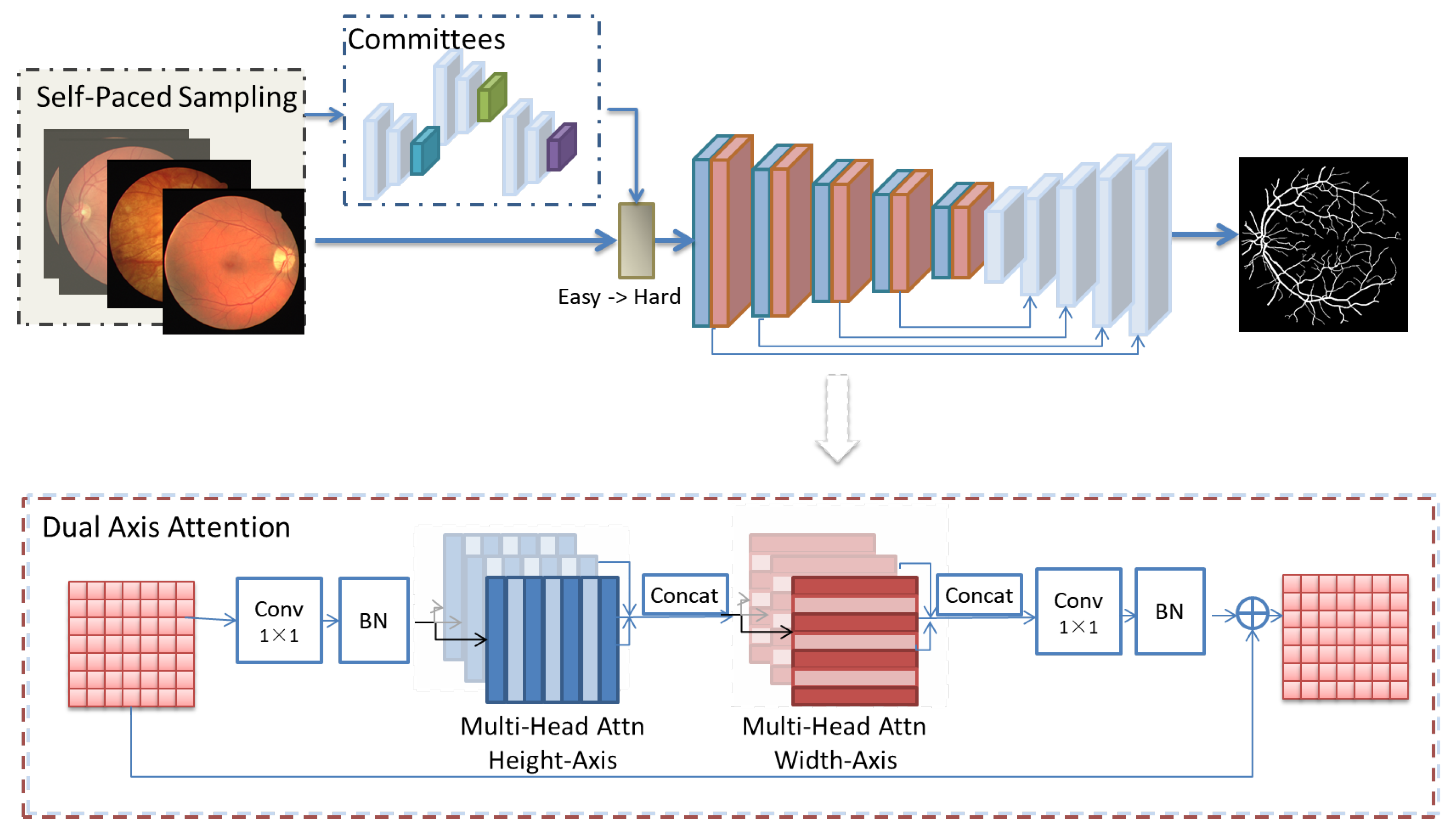 Self-Paced Dual-Axis Attention Fusion Network for Retinal Vessel Segmentation
