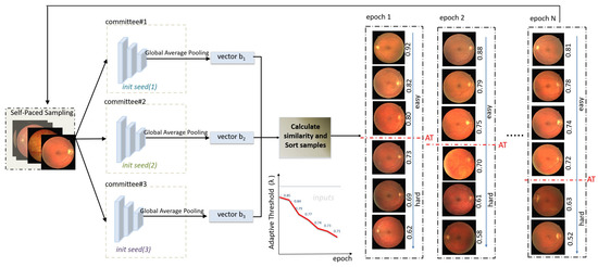 Self-Paced Dual-Axis Attention Fusion Network for Retinal Vessel ...