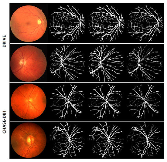 Self-Paced Dual-Axis Attention Fusion Network for Retinal Vessel ...