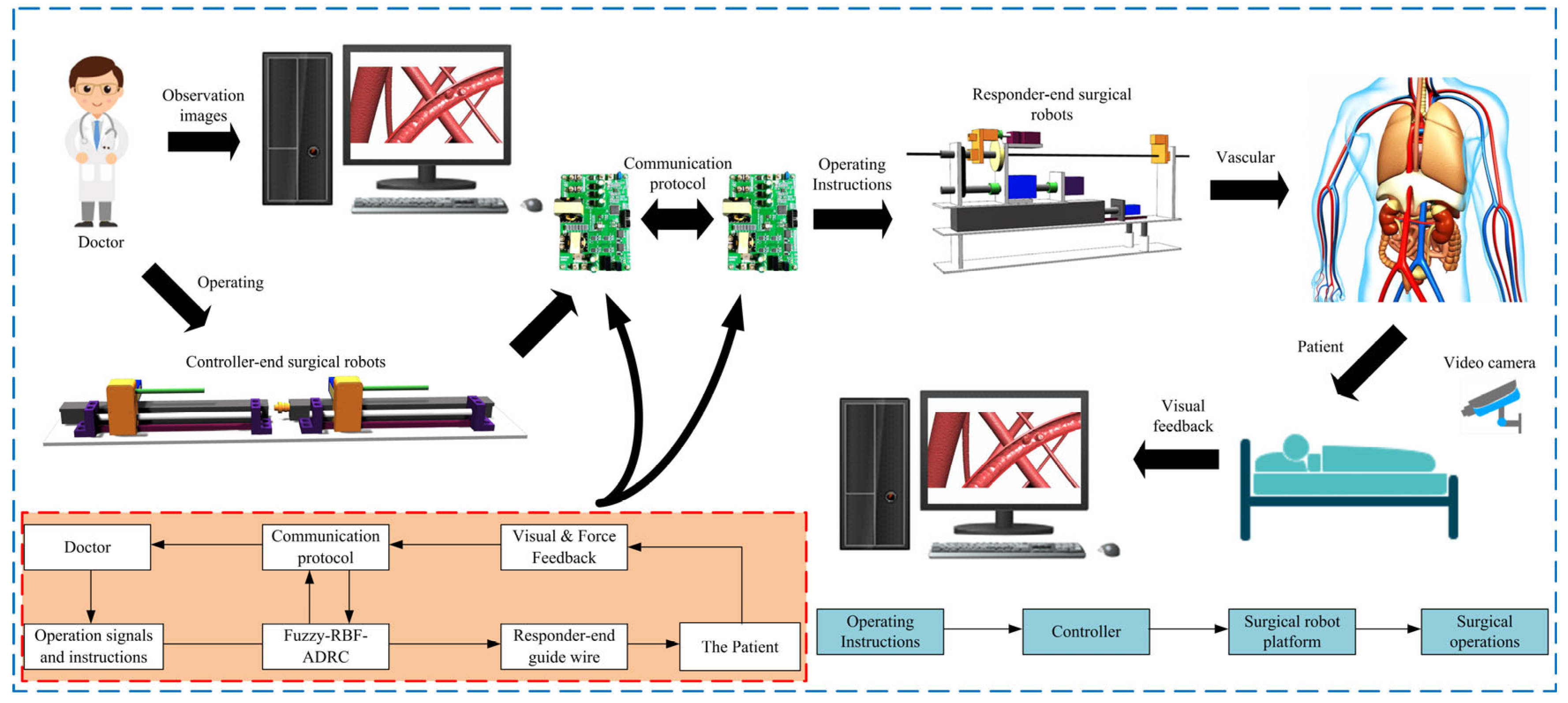 Stability Study of an Interventional Surgery Robot Based on Active ...