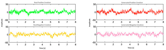 Automatic Emotion Recognition from EEG Signals Using a Combination of Type-2 Fuzzy and Deep ...