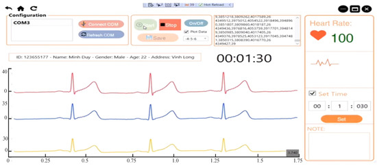 The Design and Construction of a 12-Channel Electrocardiogram Device ...