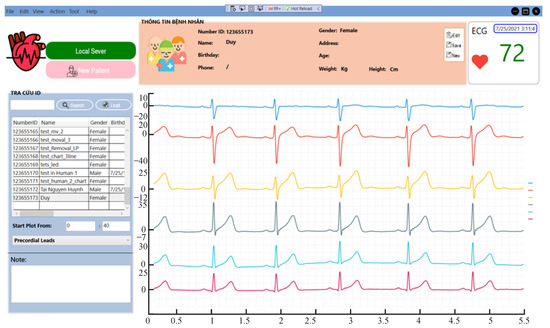 The Design and Construction of a 12-Channel Electrocardiogram Device ...