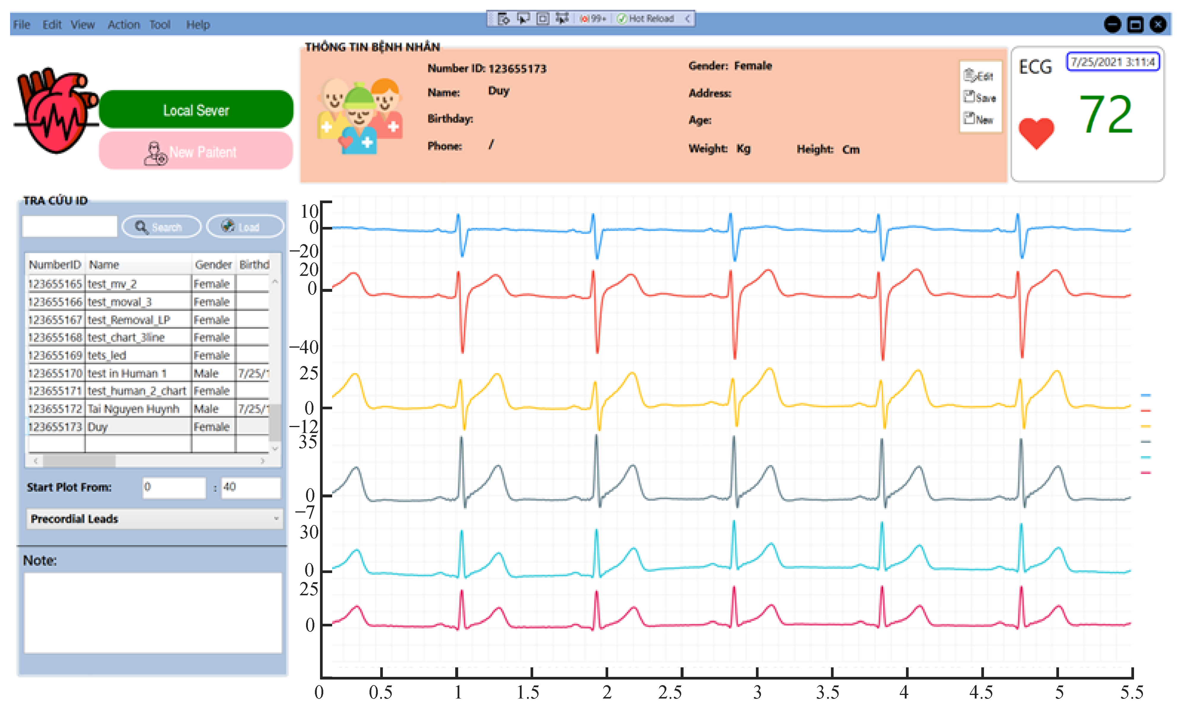 The Design and Construction of a 12-Channel Electrocardiogram Device Developed on an ADS1293 ...