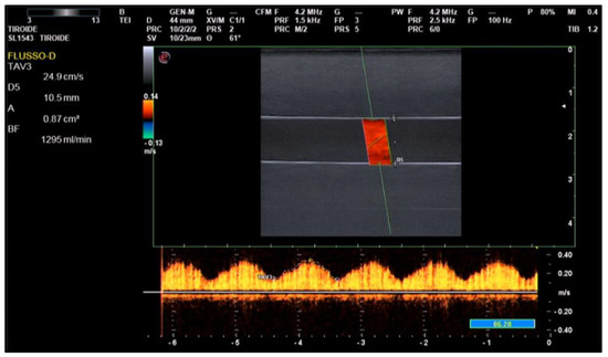 A Mechatronic Cardiovascular Simulation System for Jugular Venous Echo ...