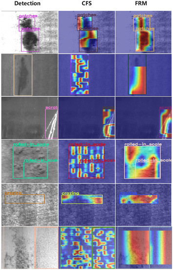 Electronics | Free Full-Text | Improving the Performance of the Single ...