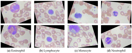 Shifted Window Vision Transformer for Blood Cell Classification